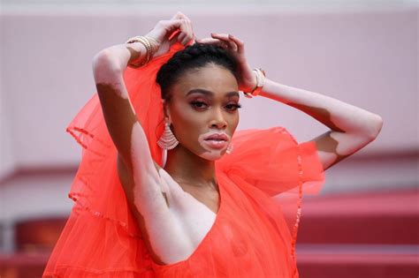 Winnie Harlow Erotic The Fappening Leaked Photos