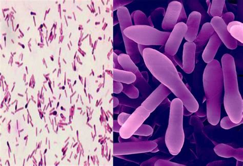 Clostridium Flashcards Quizlet