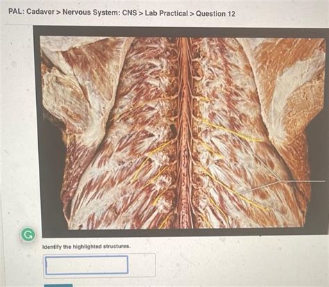 [solved] Pal Cadaver Nervous System Cns Lab Practical