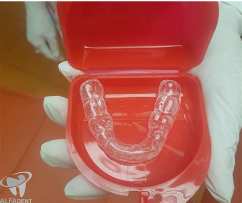 Náhryzová Dlaha Proti škrípaniu Zubov Bruxizmu Alfadent