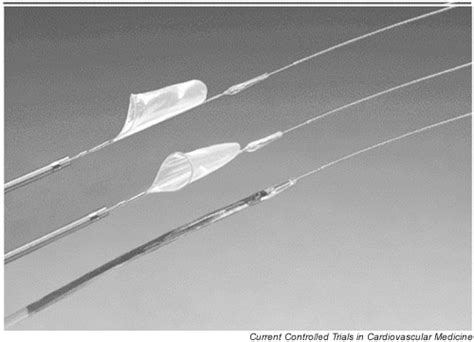 The FilterWire Guidewire Filter Device And Retrieval Catheter