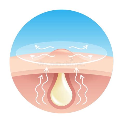 Pimple Patch Stock Illustrations 75 Pimple Patch Stock Illustrations