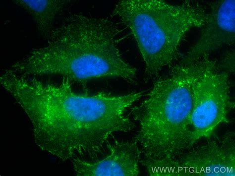 Icam 1cd54 Antibody 83069 6 Pbs Proteintech