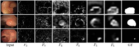 Figure 10 From Adaptive Context Exploration Network For Polyp