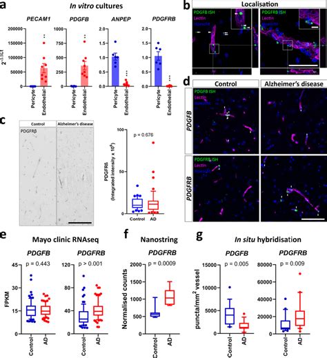 Pdgf Bb Pdgfrβ Signalling Components Are Altered In The Ad