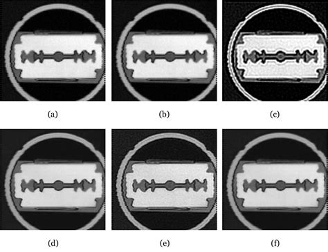 231201638 J Net Improved U Net For Terahertz Image Super Resolution