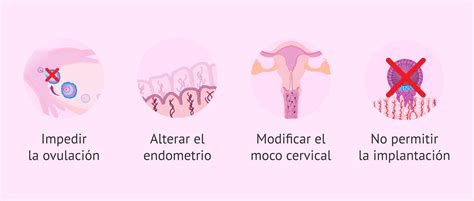 Los Métodos Anticonceptivos Tipos Eficacia Riesgos Y Precios