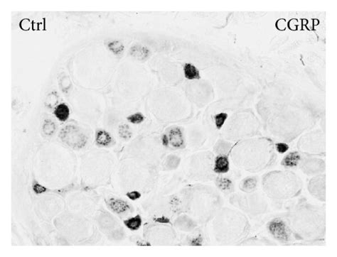 Immunoreactivity To Trpv1 A And D Cgrp B And D And Sp Download Scientific Diagram