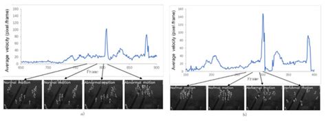 Sensors Special Issue Sensor Fusion For Object Detection