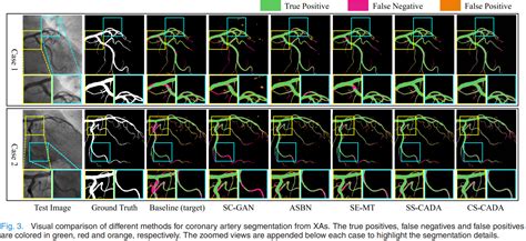 【tmi2023】contrastive Semi Supervised Learning For Domain Adaptive