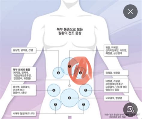 걸으면 명치 왼쪽 통증이 있습니다 ㅣ 궁금할 땐 아하