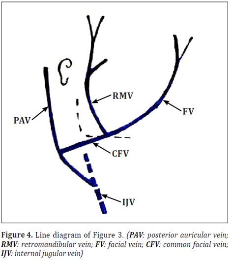Jugular Vein Diagram