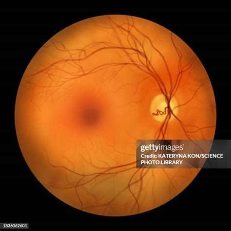 Prepapillary Vascular Loop On The Retina Illustration High Res Vector