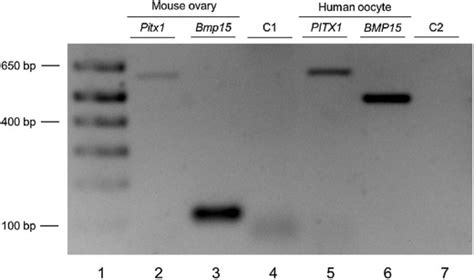 Bmp15 C 9cg Promoter Sequence Variant May Contribute To The Cause Of