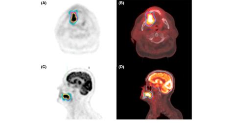 Hand Crafted Blue And Computer Assisted Using Thresholding Yellow Download Scientific