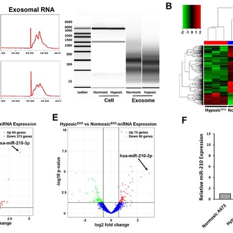 Ews Hypoxic Exo Carry Specific Hypoxia Regulated Mirna A