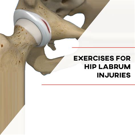 Exercises For Hip Labrum Injuries [p]rehab