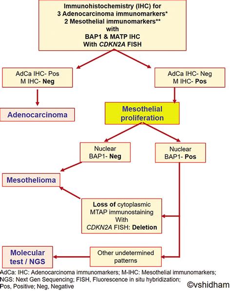 Mesothelioma Cytojournal