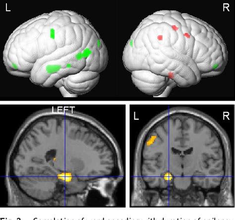 figure 2 from factors affecting reorganisation of memory encoding