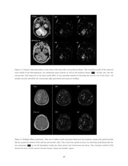Simple Statistical Methods For Unsupervised Brain Anomaly Detection On