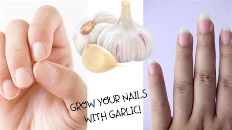 Grow Your Nails In 7 Days With Garlic Oil How To Grow Nails Grow