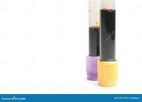 Medische Reageerbuizen In Laboratorium Met Ruimte Voor Tekst Stock Foto