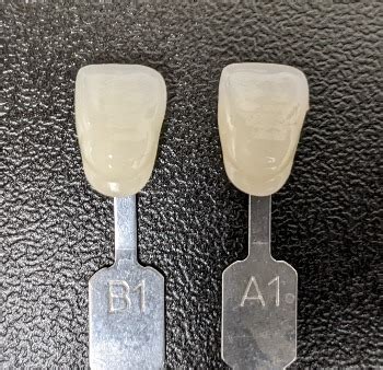 The Natural Color Of Teeth Afterva Oral Health Library