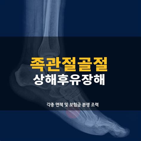 족관절골절 상해후유장해 보상사례 확인하기 네이버 블로그
