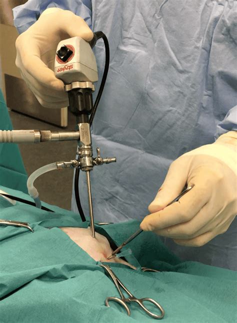 Minimally Invasive Keyhole Arthroscopy 2000 Performed By