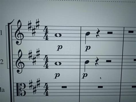 Default P Dynamic Marking Is Off Center With Whole Notes · Issue 18615