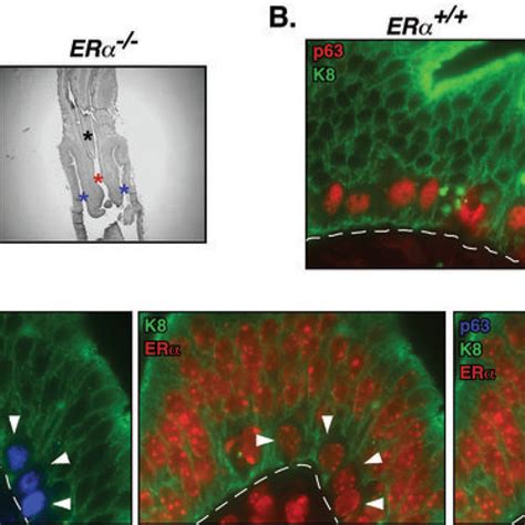 Erα −− Mouse Retains Intact Cervical Structure And Reserve Cells