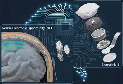 Fully Implantable Wireless Brain Computer Interface For Humans