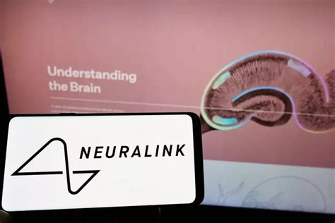 Neuralink Empresa De Implantes Cerebrais De Elon Musk Multada Por