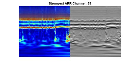 Classify Time Series Using Wavelet Analysis And Deep Learning