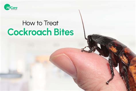 Cockroach Bite Check Symptoms Treatment And Prevention Tips