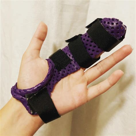 Radial Gutter Splint Pattern