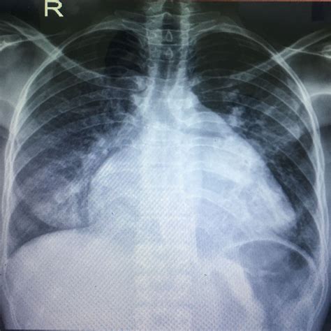 Pin Di Hussein Allaw Su Radiology