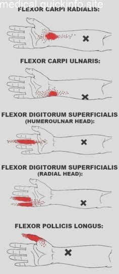 Human Body Anatomy Muscle Anatomy Trigger Point Therapy Medical Anatomy Occupational