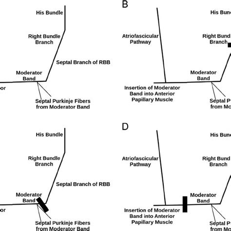 Right Bundle Branch Anatomy And Sites Of Right Bundle Branch Block A Download Scientific