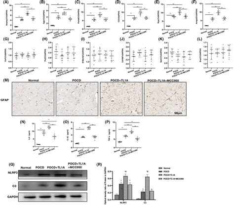 TL1A Promotes The Postoperative Cognitive Dysfunction In Mice Through