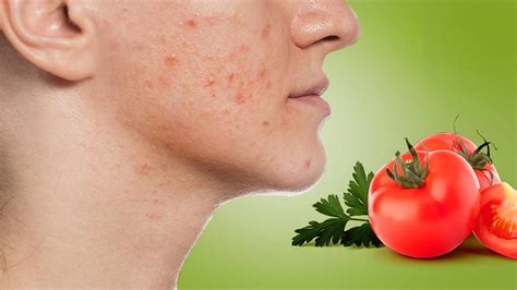 Scaly Red Spots On Skin 22 Common Skin Rashes Causes Symptoms And Treatments Explained