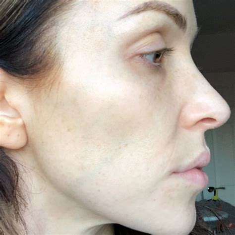 Anti Eyebrow Scar