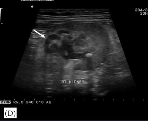 Abdominal Ultrasound Findings In A Cat With Recurrent Hydronephrosis Download Scientific