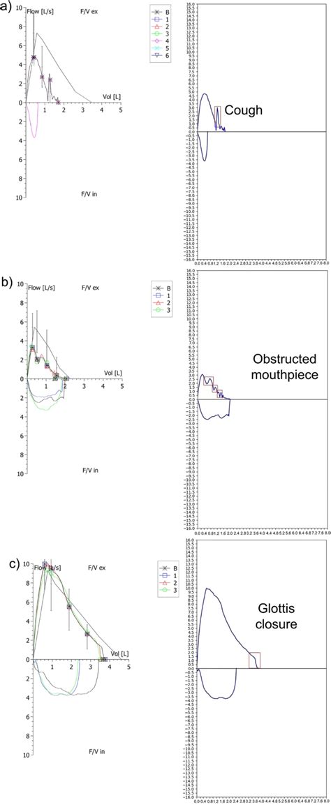 Allergy Asthma And Immunology Deep Learning For Spirometry Quality