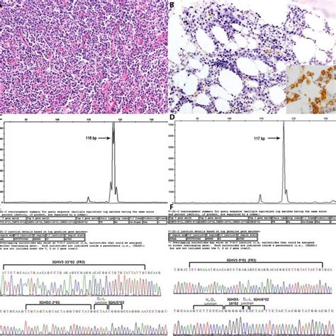 Representative Case 4 Histopathology Sections Of A Lymph Node Download Scientific Diagram