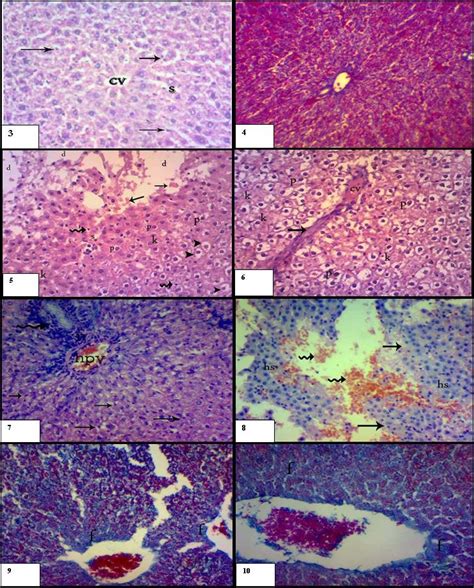 Photomicrographs Of Sections In Liver Tissue Of The Control And Treated
