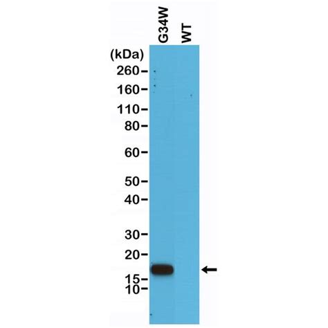 H33 G34w Oncohistone Mutant Recombinant Monoclonal Antibody Rm263