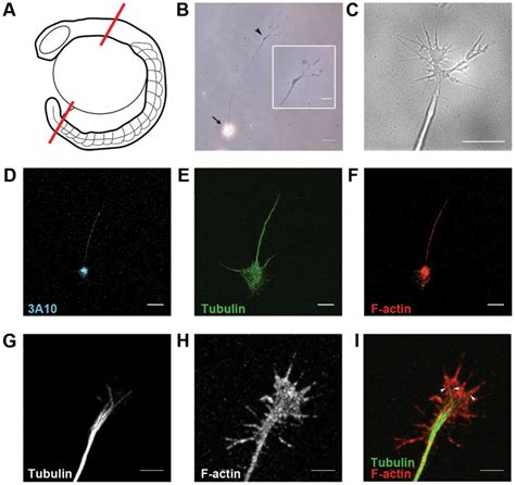 A Diagram Of Spinal Cord Dissection Red Lines Indicate Cut Sites