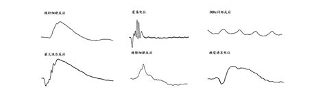 视觉电生理仪