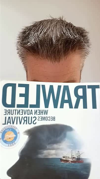 Eoin Ryan On Linkedin Trawled